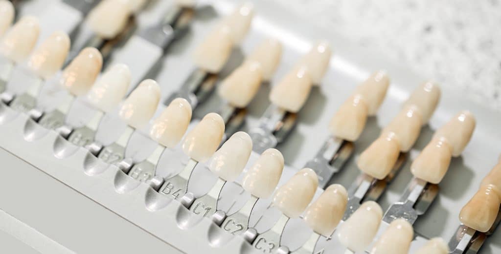 Crown & Bridge - Integrity Dental Services