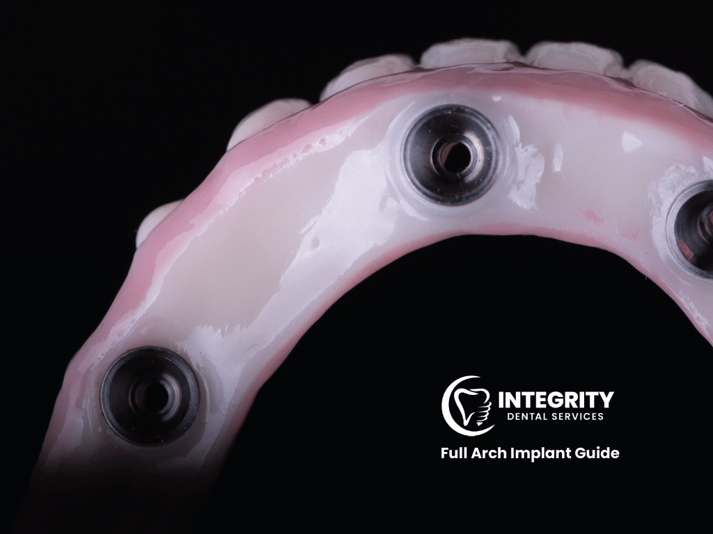 Full Arch Implant Guide Download - Integrity Dental Services